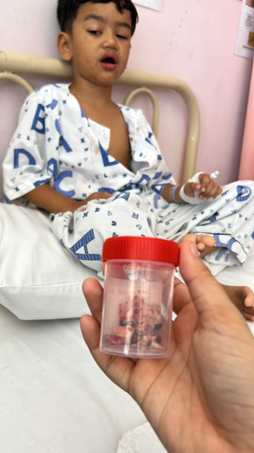 Jarang Gosok Gigi, Ibu Kongsi Kisah Anak Terpaksa Cabut 12 Batang ...