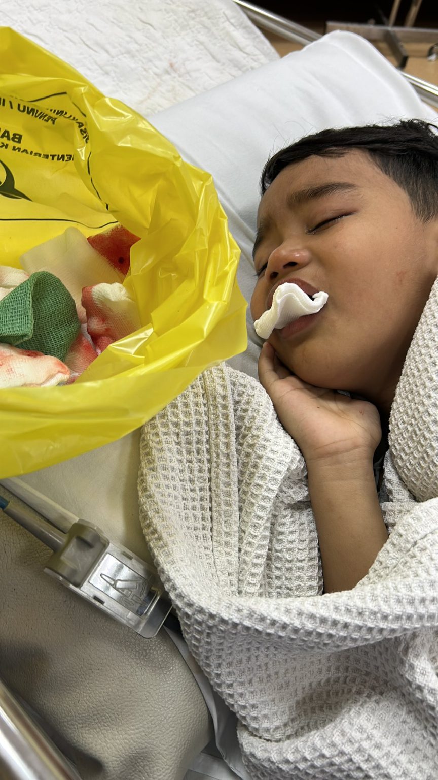 Jarang Gosok Gigi, Ibu Kongsi Kisah Anak Terpaksa Cabut 12 Batang ...